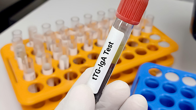 Keliakialiitto - Keliakialiitto